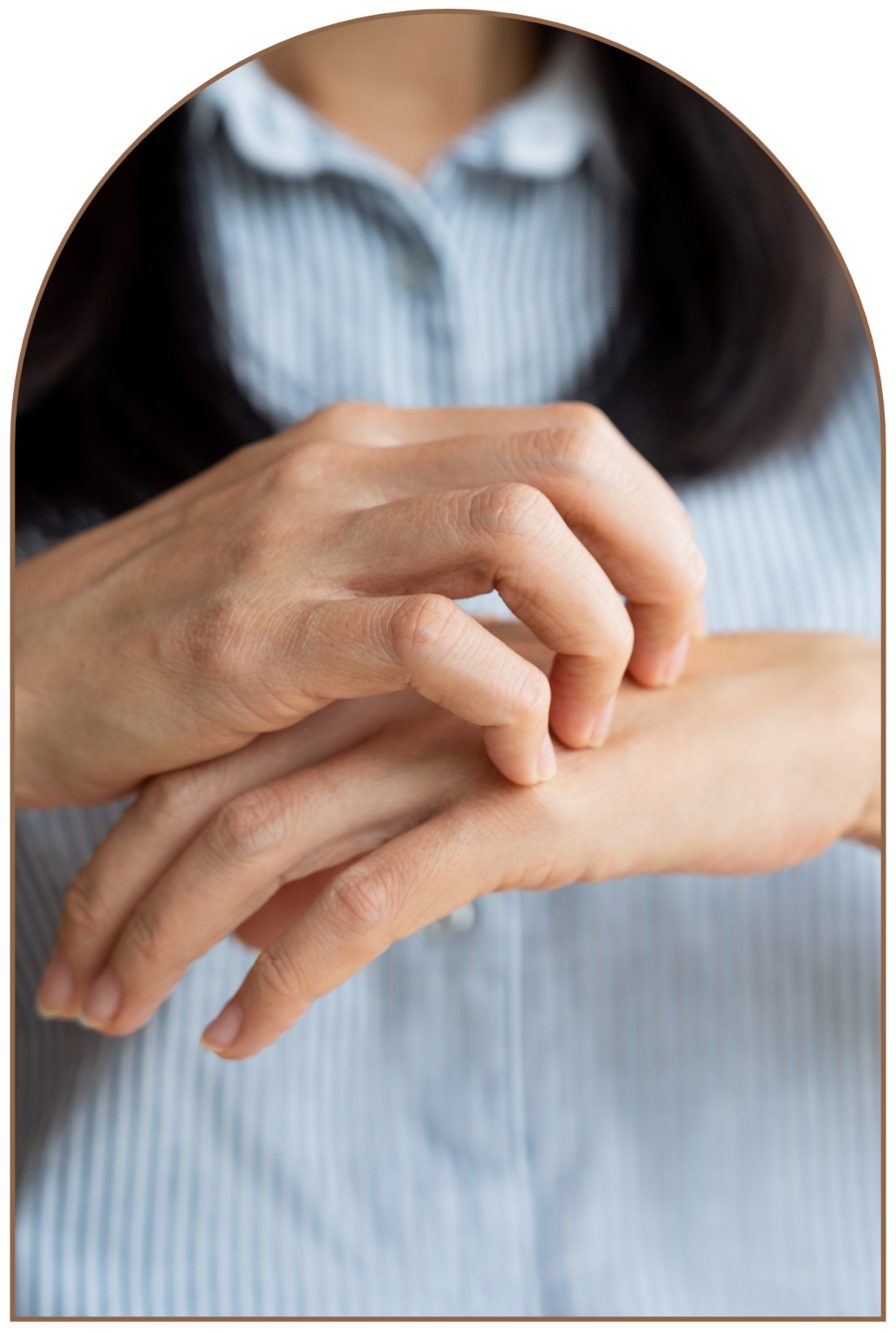 Psoriasis Treatments in Chicago, IL | Skin MD, LLC